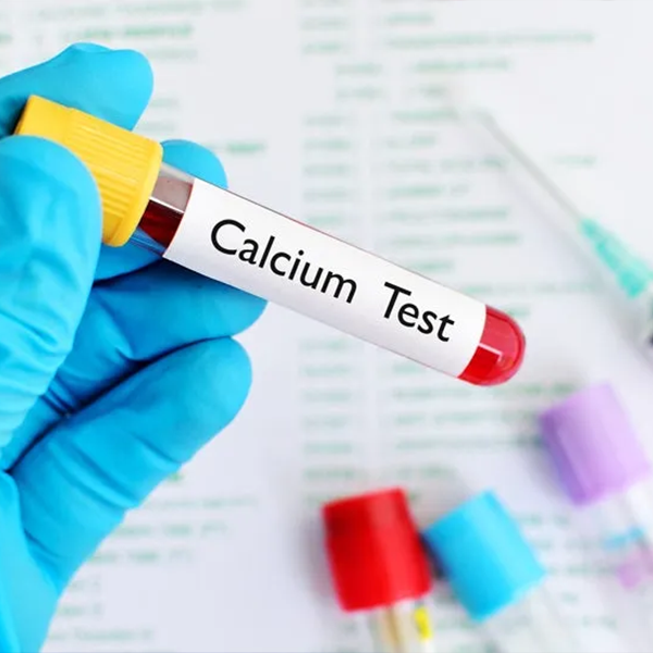 CALCIUM TEST