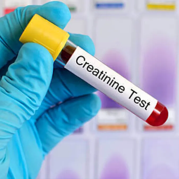 Creatinine Blood Test