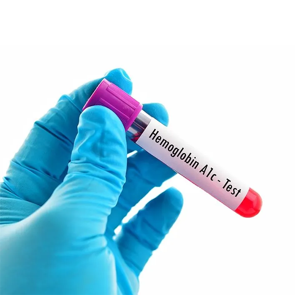 Hba1C(Glycosylated Hb) Test - Blood Glucose