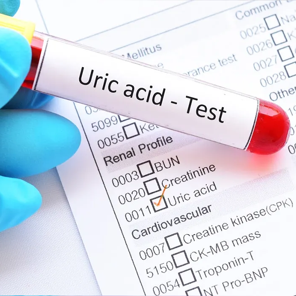 URIC ACID TEST
